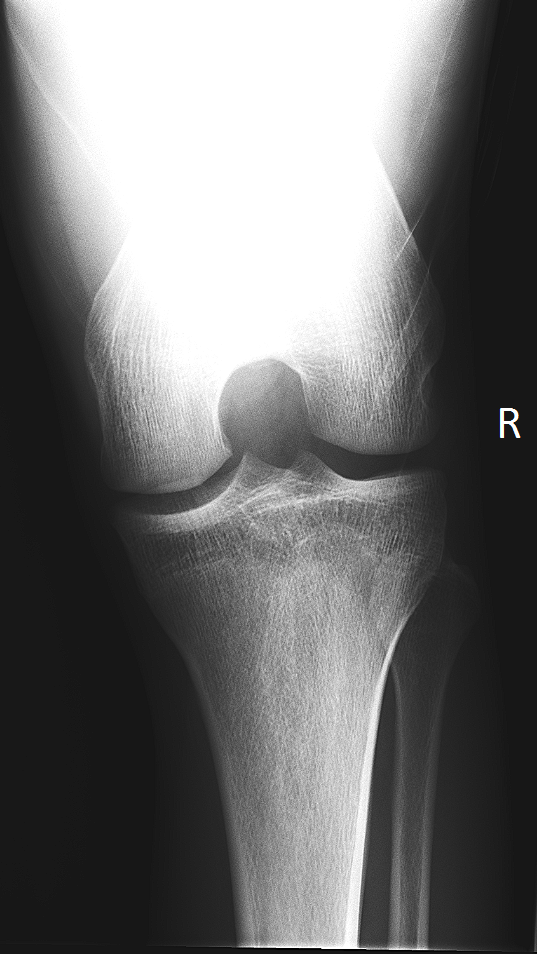Same Tunnel Different View – JL Radiology