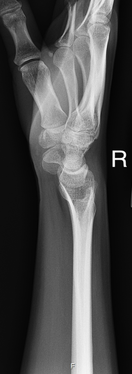 The Perfect Lateral (Wrist) – JL Radiology
